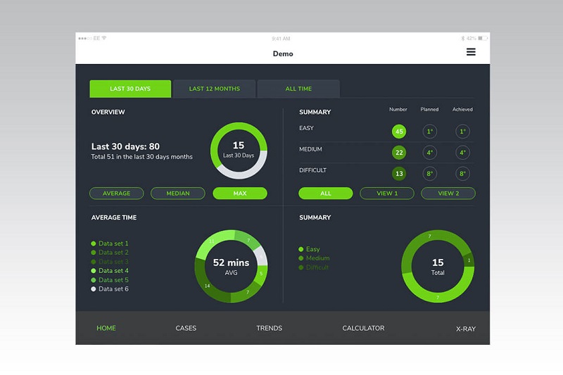 Web app to provide robotic surgery analytics to support new workflows